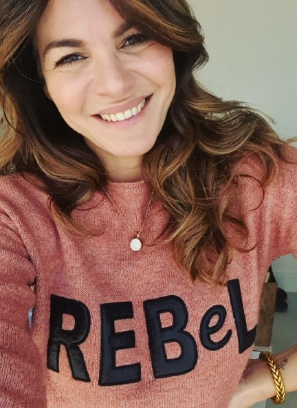 Fabiola Martínez reconoce sufrir alopecia y enseña cómo le afecta