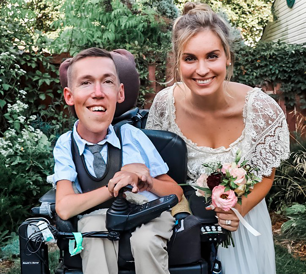 Shane Burcaw y Hannah Aylward: una historia de amor sin barreras